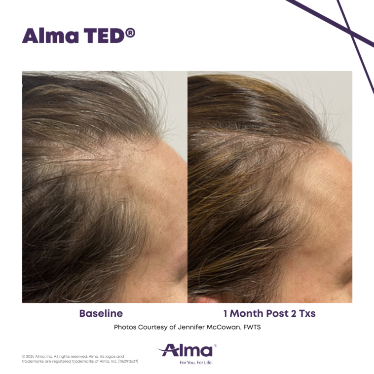 Ask The Expert: Alma TED | Fargo Monthly